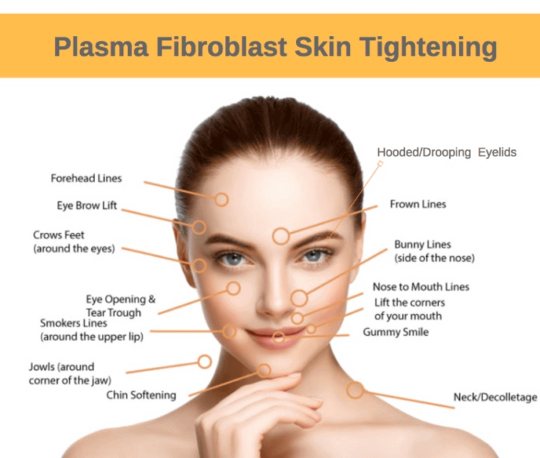 Fibroblast Therapy